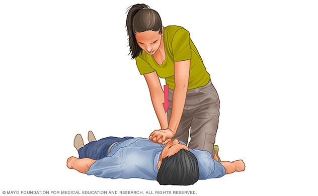 Basic Life Support- Never Heard About It! | Sushant University blog